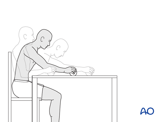 Nonoperative treatment for Medial, complete articular clavicle fracture