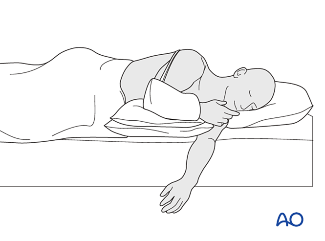 Nonoperative treatment for Medial, complete articular clavicle fracture