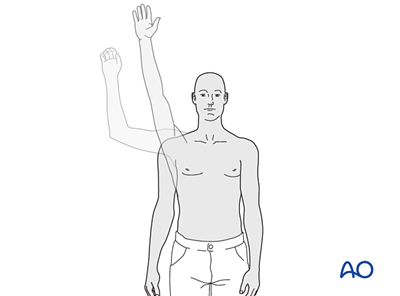 Postoperative treatment of clavicle fractures
