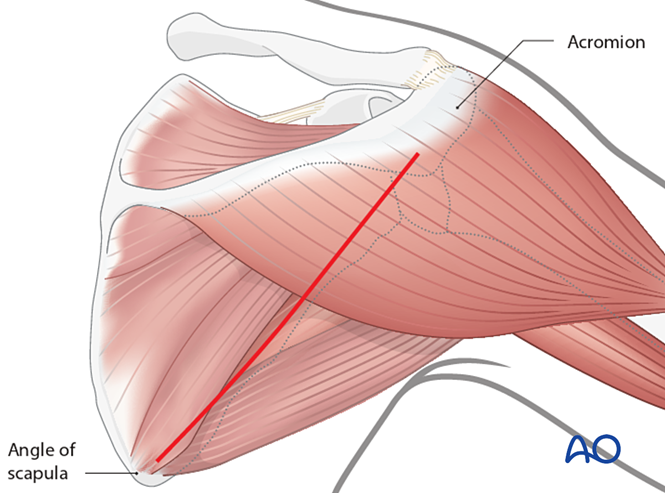 Posterior approach to the scapular body