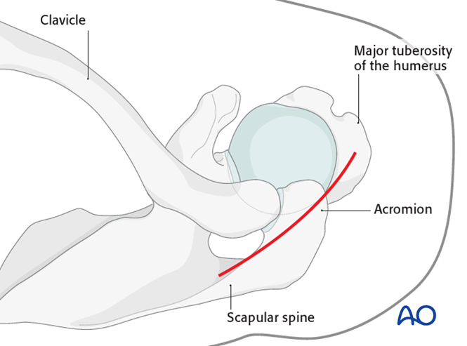 Superior approach to the acromion