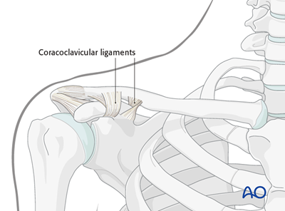 Superior approach to the clavicle