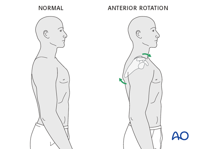 Clinical and radiological examination
