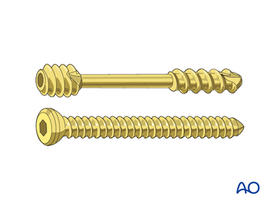 Lag screw for Radius, partial articular