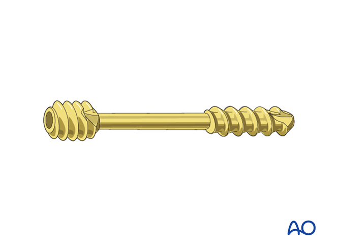 Lag screw for Radius, partial articular