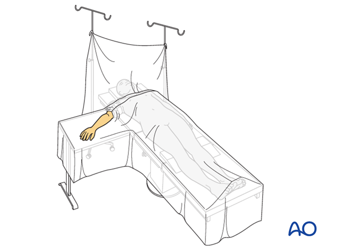 Supine for lateral access