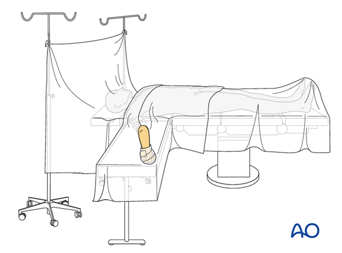 Supine for anterior access