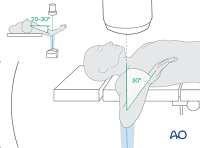 Intraoperative imaging of the proximal forearm