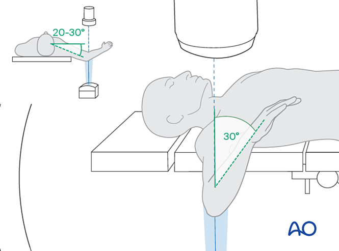 Intraoperative imaging of the proximal forearm