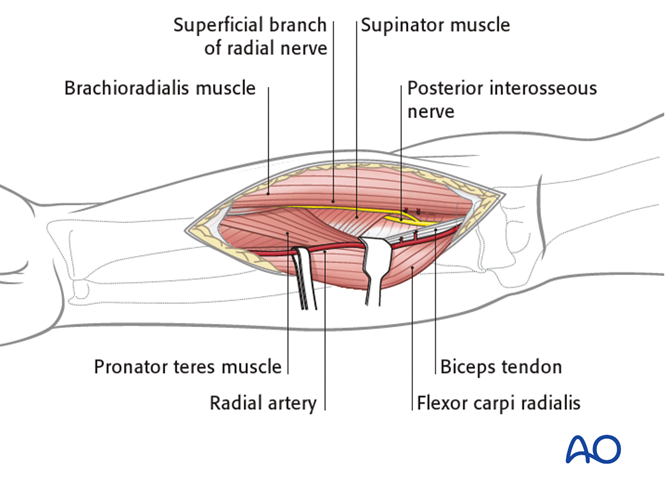 Anterior approach (Henry) to the forearm shaft