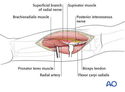Anterior approach (Henry) to the forearm shaft