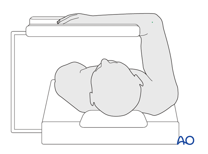 Approach to the ulna