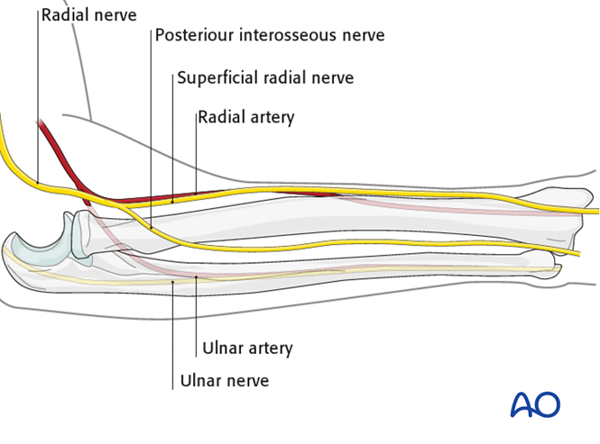 Safe zonesin the forearm for pin placement