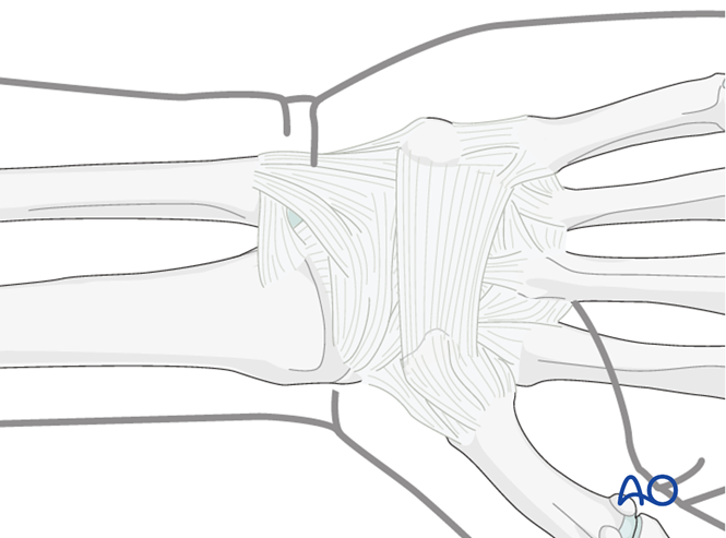 Approaches to the distal radioulnar joint (posterior/anterior)