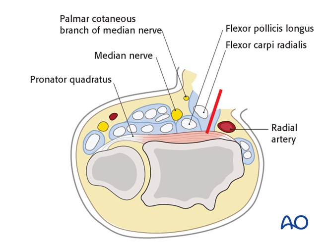 Palmar approach – modified Henry approach to the distal forearm