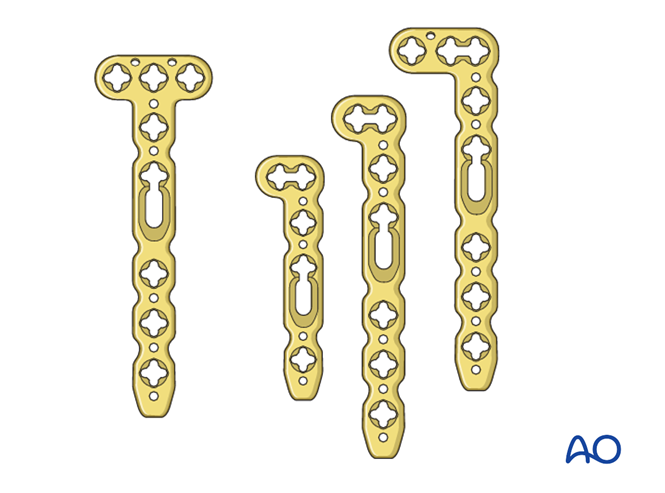 ORIF - Dorsal double plate for Partial articular fracture of the radius ...