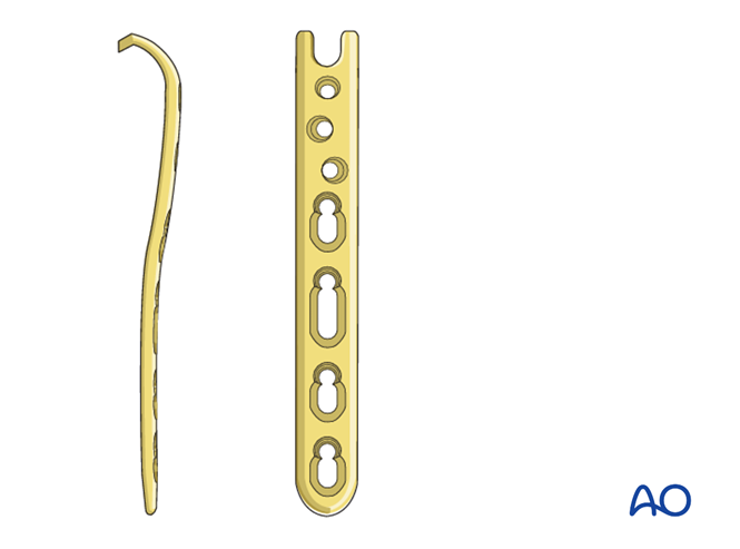 ORIF - Hook plate for Extraarticular multifragmentary fracture of the ulna