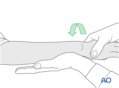 DRUJ stabilization (Galeazzi fracture-dislocation)