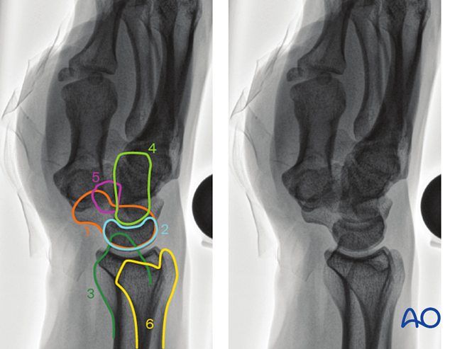 Intraoperative imaging compendium