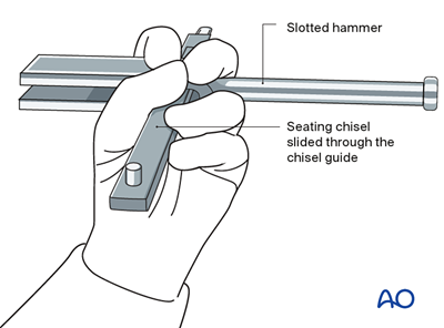 Angled blade plate for Intertrochanteric fractures