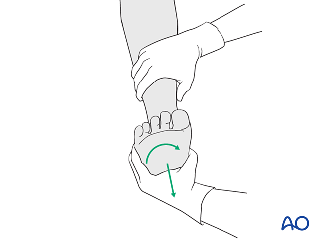 Total hip arthroplasty for Femoral neck and head fractures with hip ...