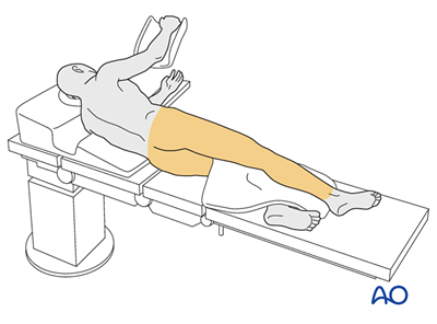 Lateral decubitus position