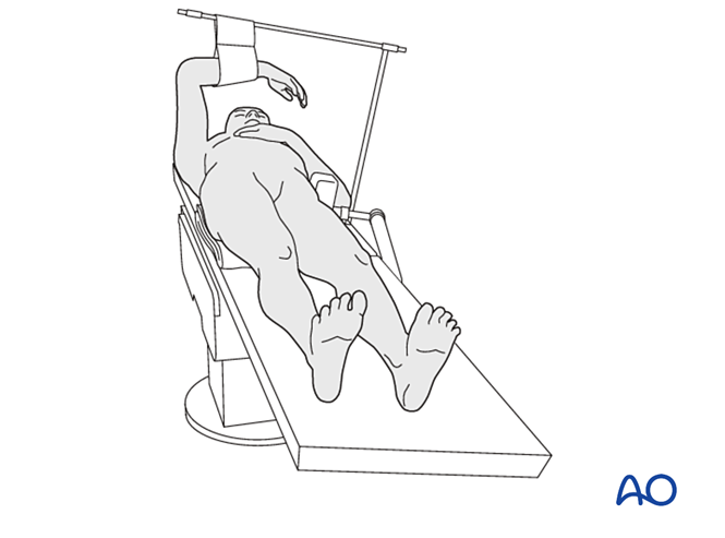 Supine patient position on a radiolucent table