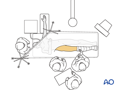 Supine patient position for arthroplasty