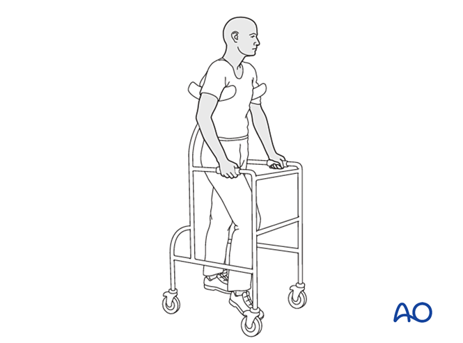 Angled blade plate for Intertrochanteric fractures