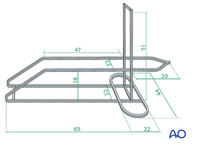 Traction for Extraarticular fracture, simple