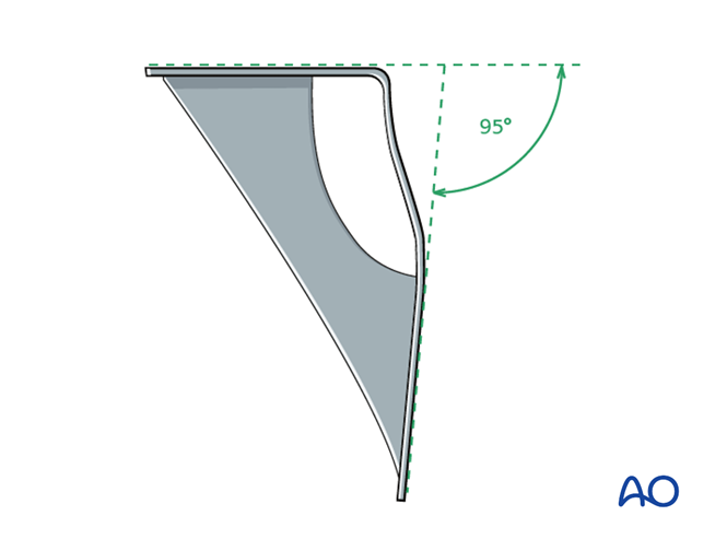 ORIF - Bridge plating (blade plate) for Simple, transverse, proximal 1/ ...