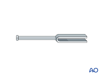 ORIF - Bridge plating (blade plate) for Simple, transverse, proximal 1/ ...