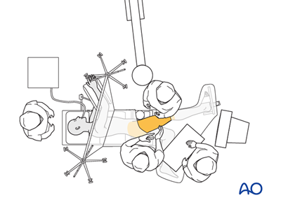 Lateral decubitus position