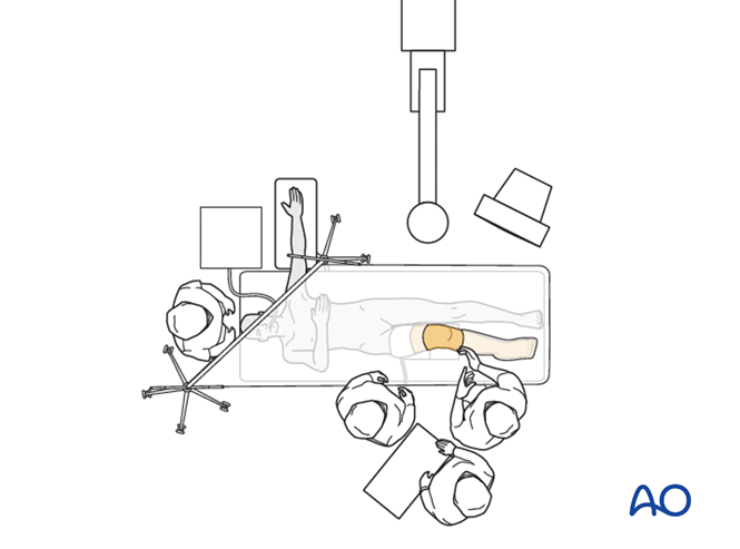 Supine position knee flexed 90°