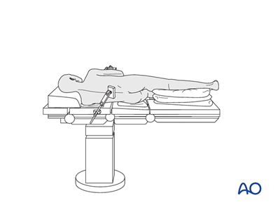 Lateral decubitus position