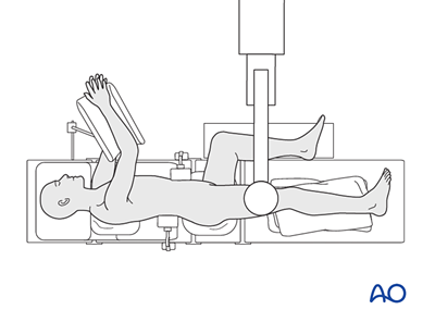 Lateral decubitus position