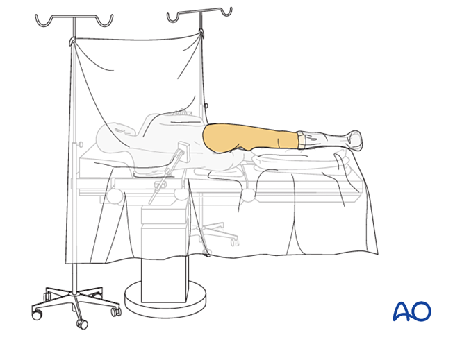 Lateral decubitus position