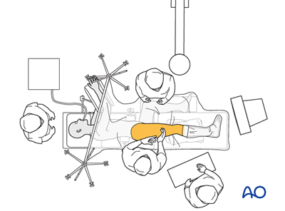 Lateral decubitus position