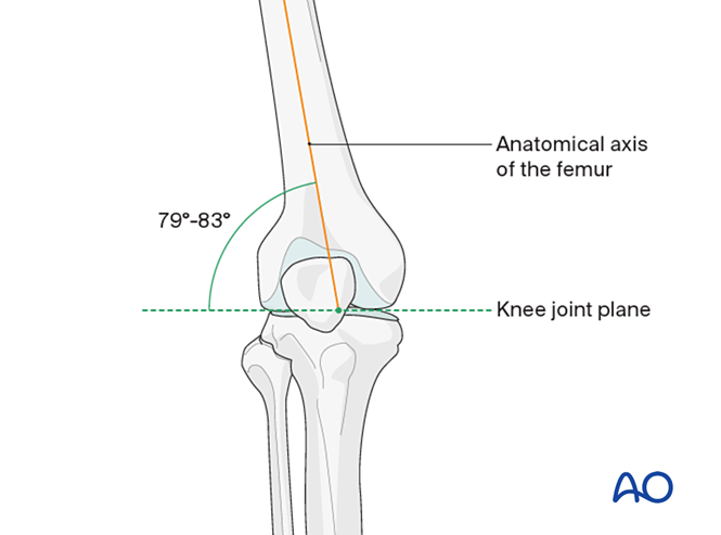 Intraoperative imaging of the distal femur