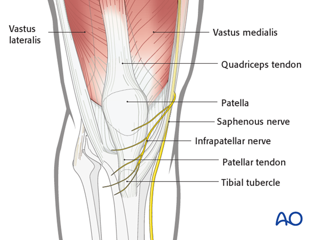 Mid-axial longitudinal approach to the patella