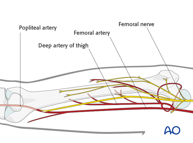 Safe zones in the tibia for pin placement