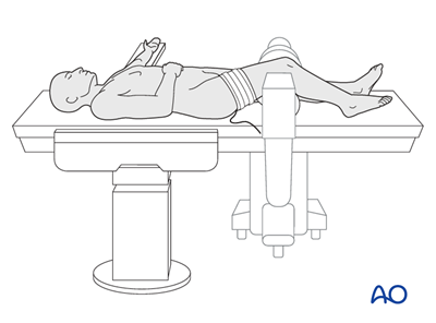 Supine position