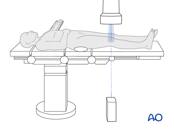 Intraoperative imaging of the proximal tibia