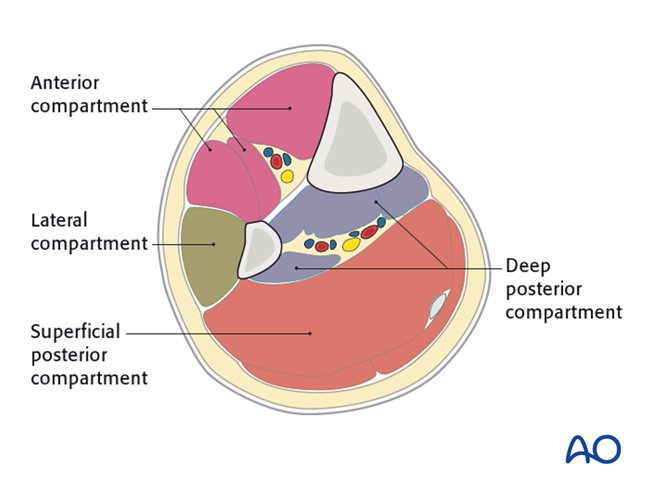 Approach to the anterolateral surface of the tibia