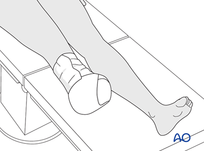 Prevention of infection