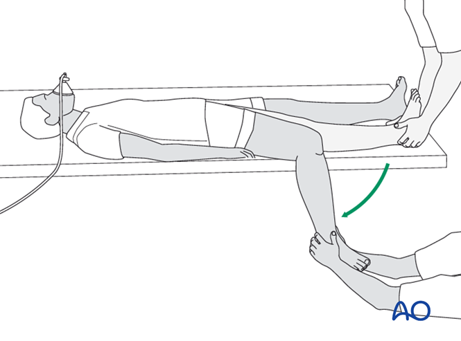Fracture management with limited resources