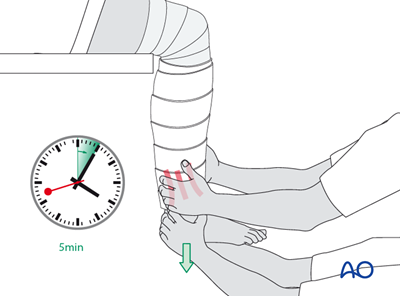 Fracture management with limited resources