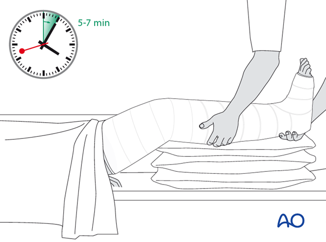 Fracture management with limited resources