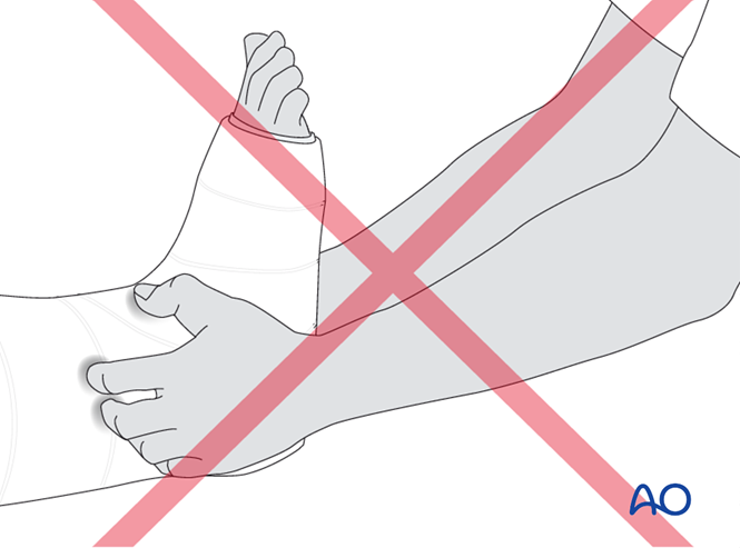 Fracture management with limited resources