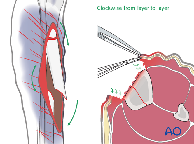 Prevention of infection